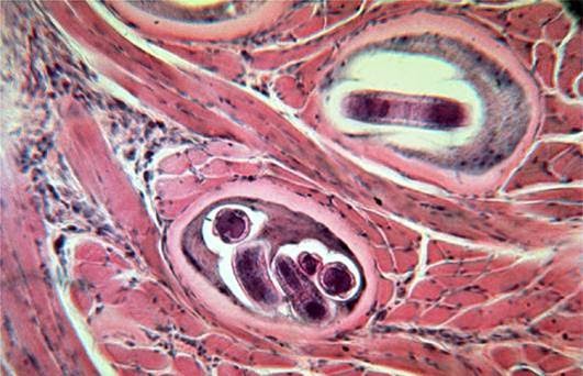 CICLO VITAL DE LA TRIQUINA: IMÁGENES DE LARVAS DE TRIQUINA ENQUISTADAS ...