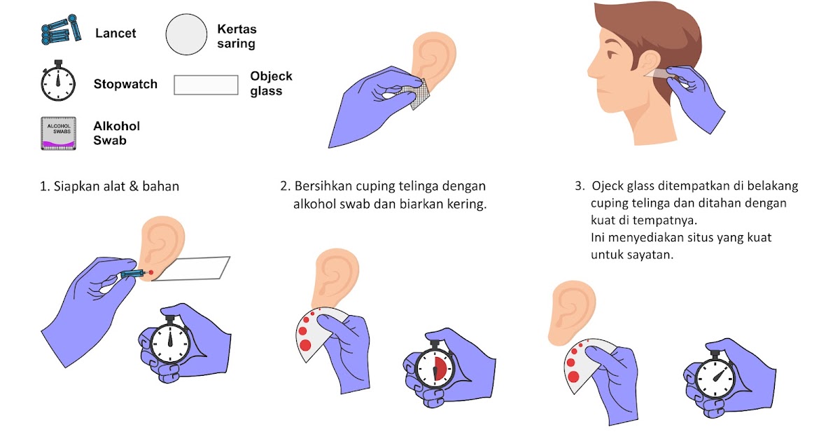 Pemeriksaan Waktu Pendarahan Bleeding Time Metode Duke Online Text pemeriksaan-waktu-pendarahan-bleeding-time-metode-duke-online-text