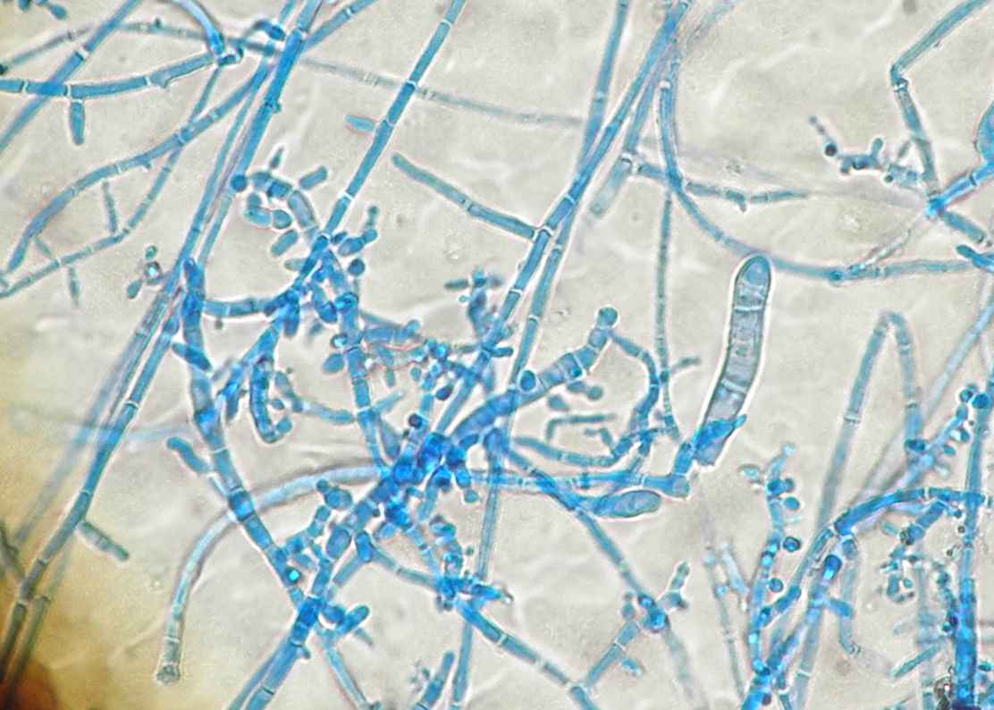 ATLAS MICOLOGIA: TRICHOPHYTON INTERDIGITALE