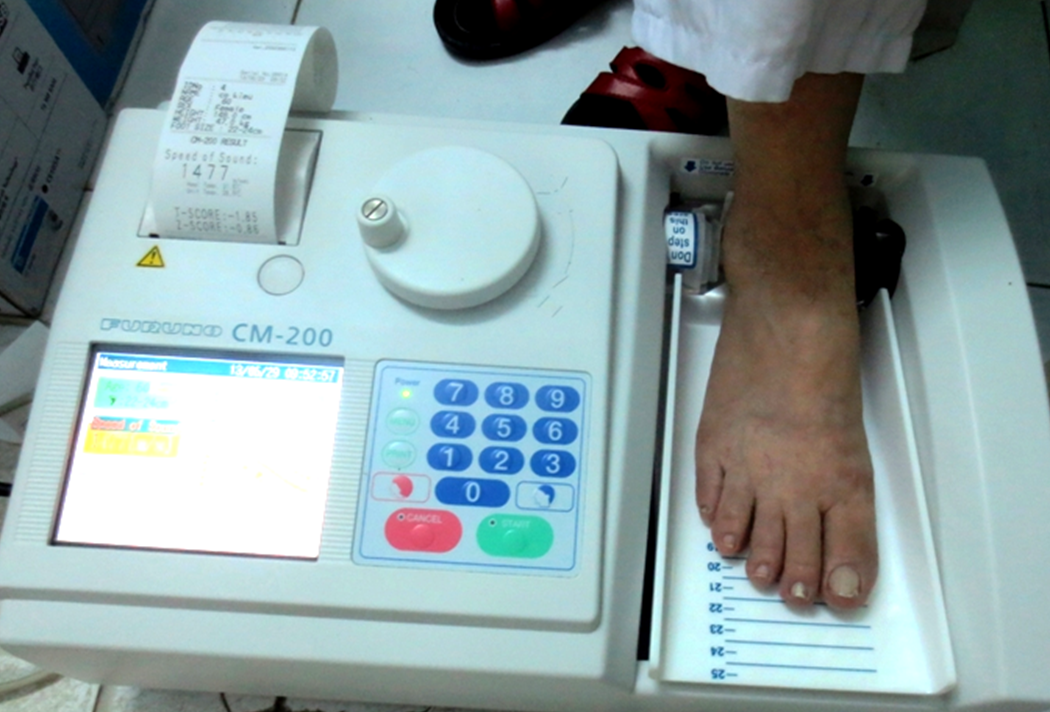 BÀI SOẠN VỀ SIÊU ÂM CHẨN ĐOÁN: Ultrasound and Osteoporosis