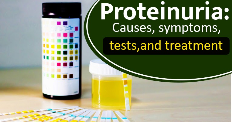 Proteinuria: Causes, symptoms, tests, and treatment