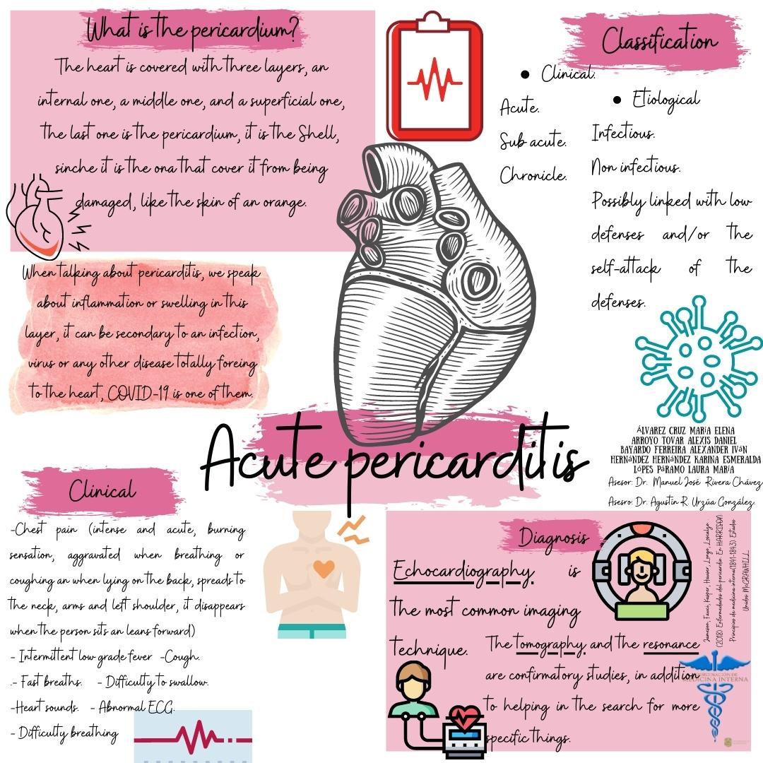 DIVULGACIÓN CIENTÍFICA UG: Pericarditis Aguda