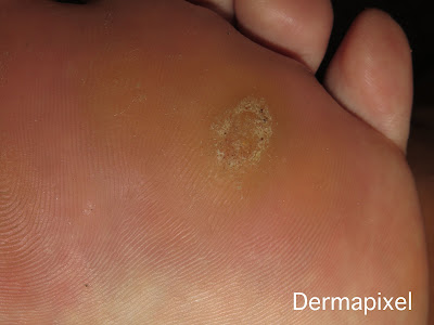 Dermapixel: septiembre 2018