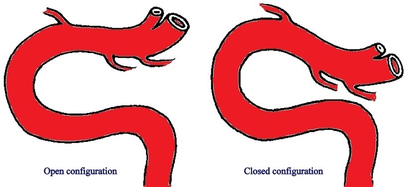 Dr Balaji Anvekar FRCR: Carotid siphon