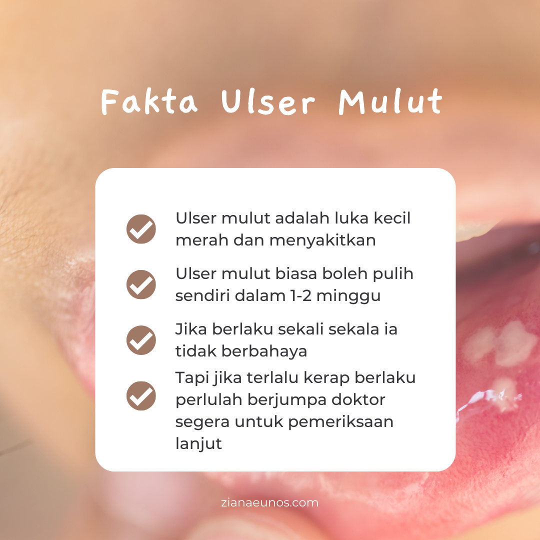 Punca dan Cara Atasi Ulser Mulut