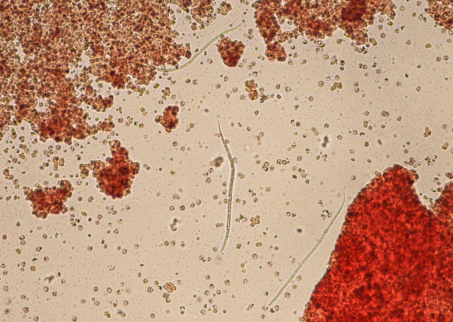 Creepy Dreadful Wonderful Parasites: Case of the Week 580