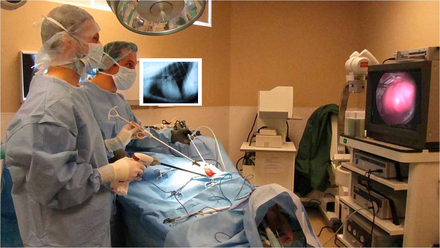 Peritoneoscopy