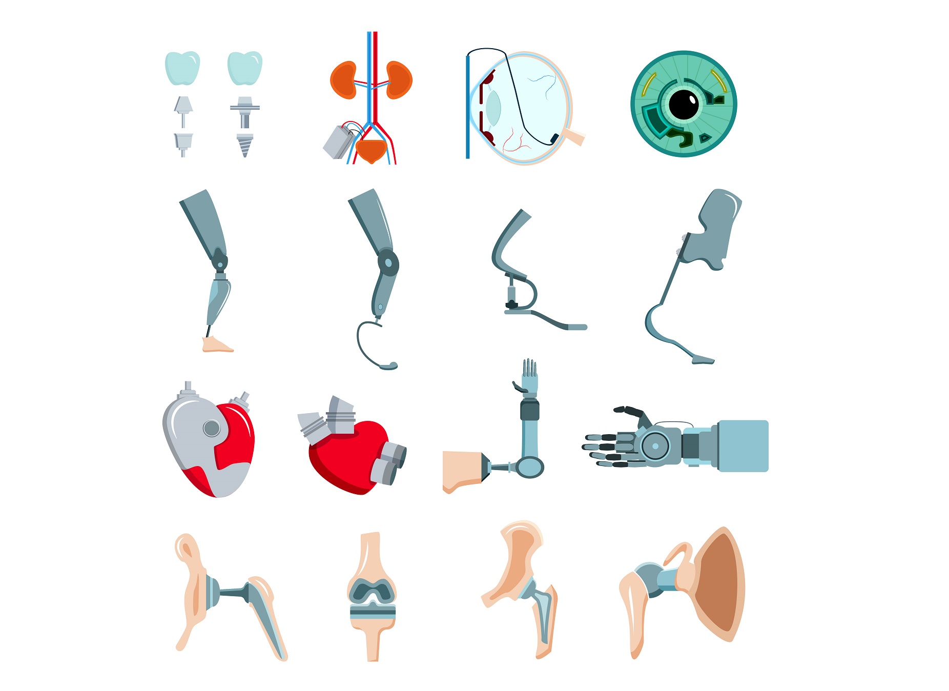 Prótesis - Salud en línea