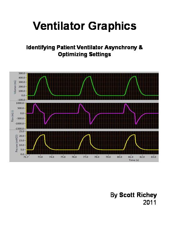 FREMITUS: Ventilator Graphics: Identifying Patient Ventilator ...
