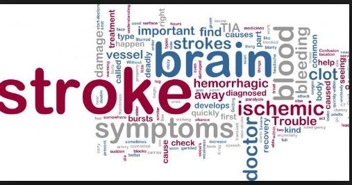 Stroke - Gejala, Klasifikasi, Dan Bagaimana Cara Mencegahnya? - ragam ...