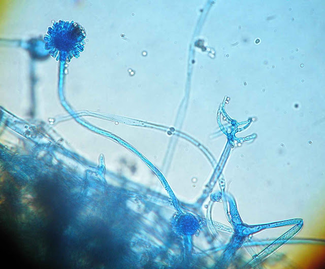 ATLAS MICOLOGIA: SYNCEPHALASTRUM RACEMOSUM