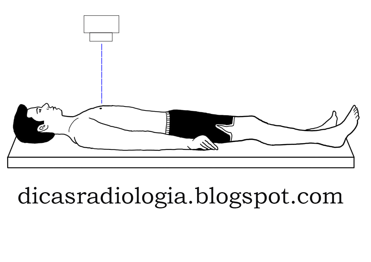 DICAS DE RADIOLOGIA - Tudo Sobre Radiologia: POSICIONAMENTO RADIOLÓGICO ...
