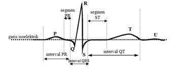 Elektrocardiogram (ECG)