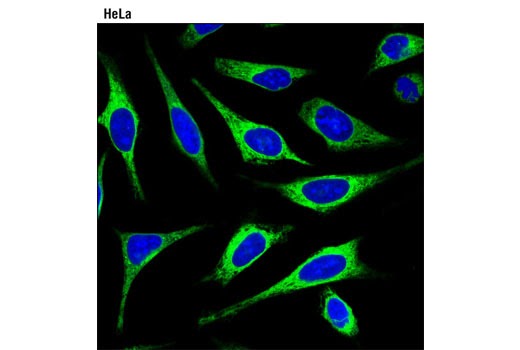 Labeling and Visualization of Endoplasmic reticulum using ER Tracker