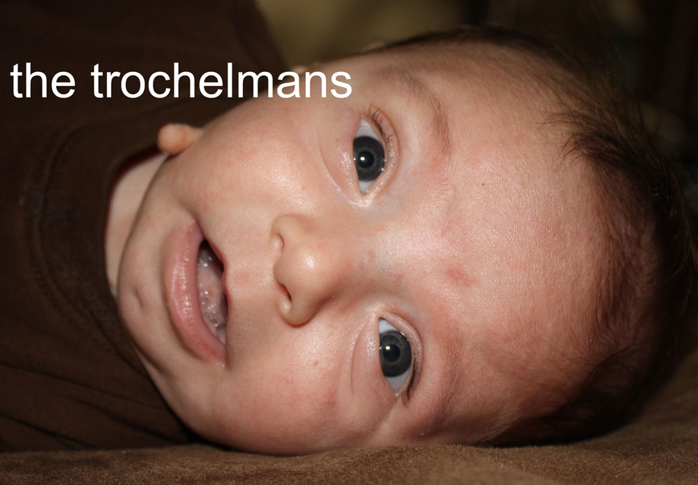 the trochelmans: Skin tag removal on our baby