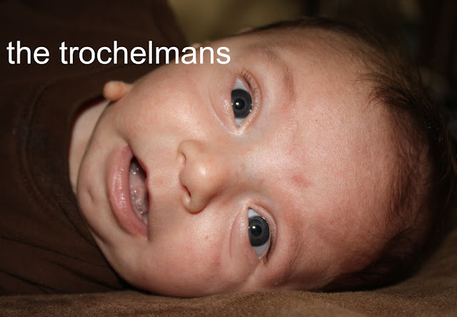 the trochelmans: Skin tag removal on our baby