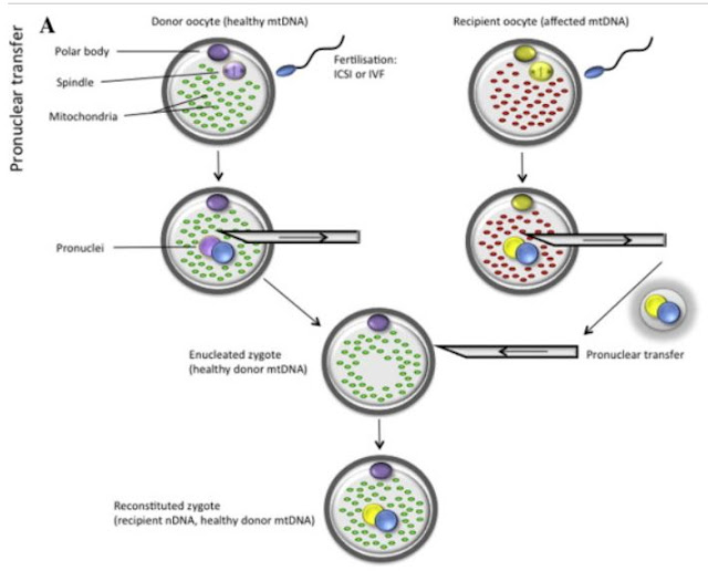 Mitochondrial Replacement Therapy