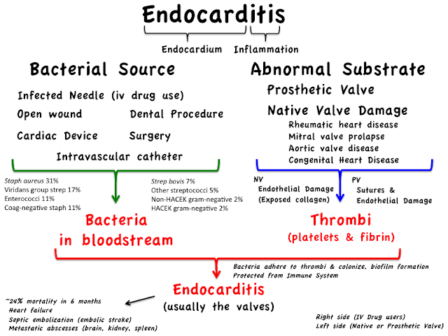 Infective endocarditis,diagnosis and treatment