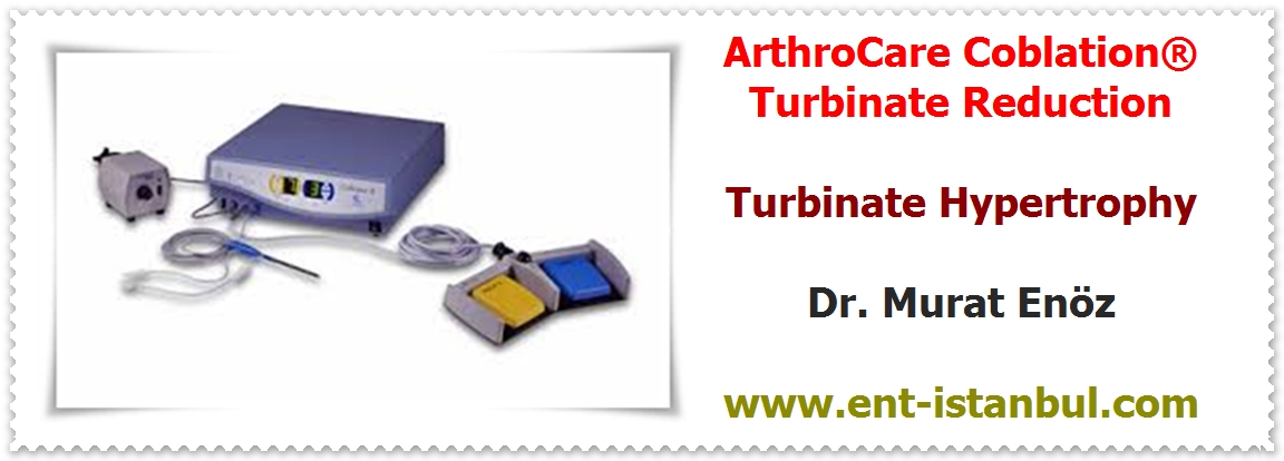 Turbinate Hypertrophy - Definition, Symptoms, Causes and Treatment