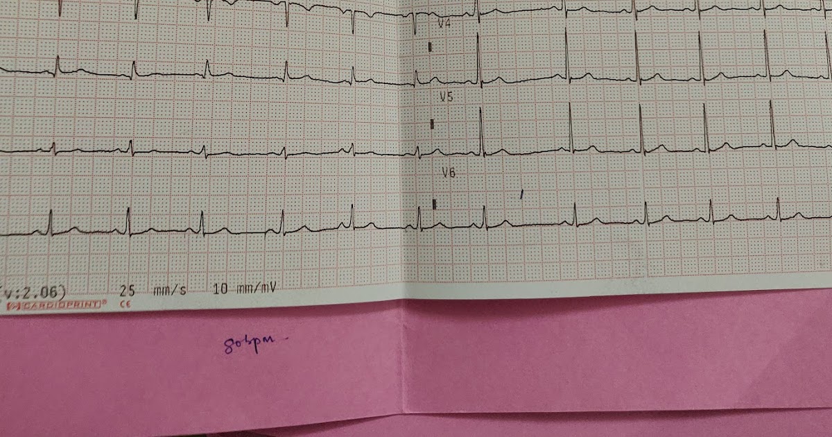Dizziness under Evaluation