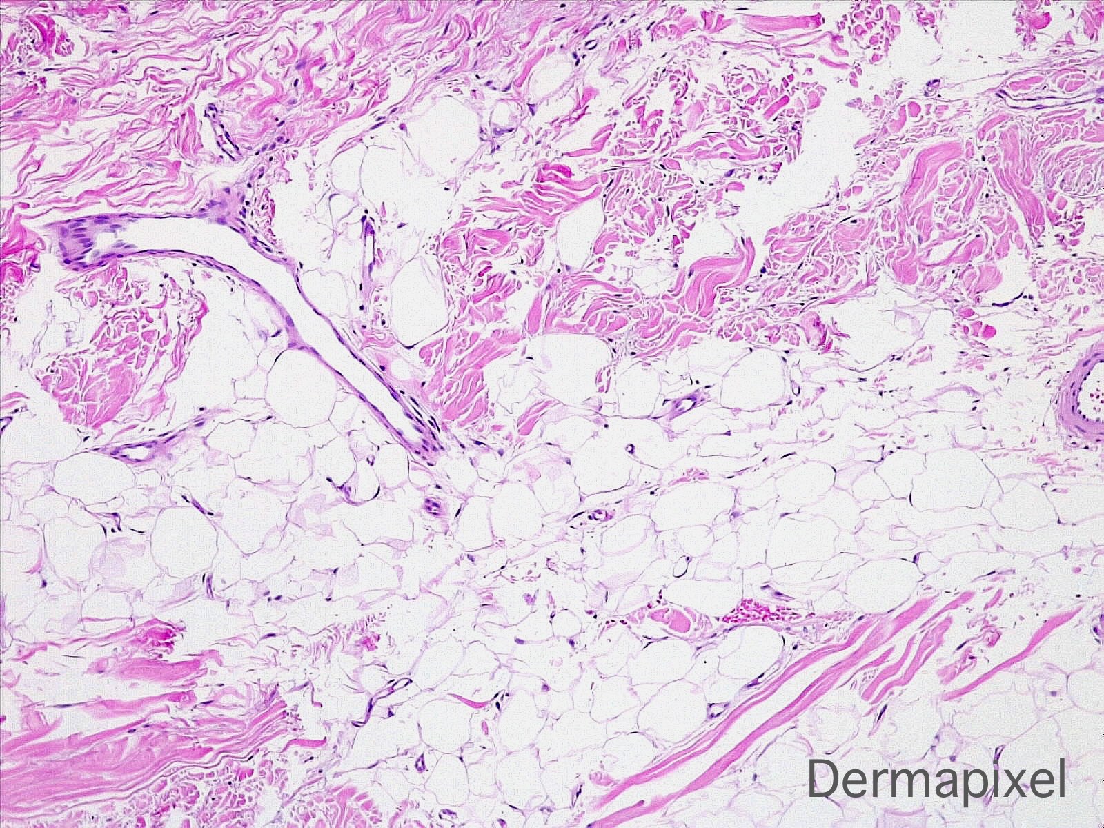 Dermapixel: julio 2021