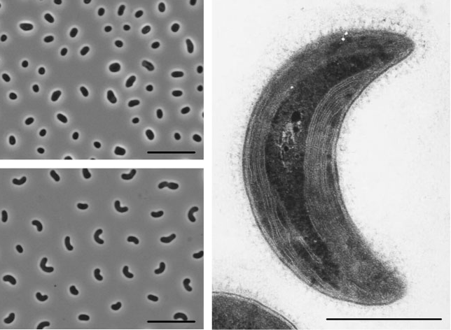 Sciency Thoughts: Understanding the role of methane-oxidising Bacteria ...