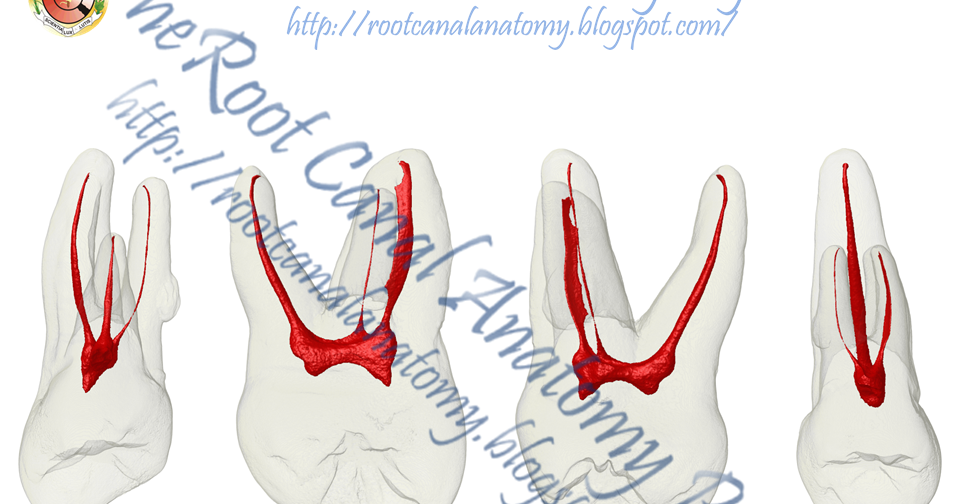 The Root Canal Anatomy Project: Maxillary First Molar
