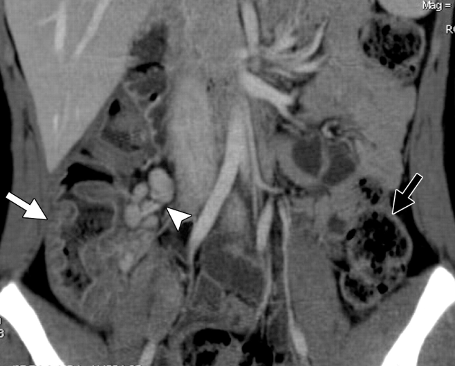 EL RINCÓN DE LA MEDICINA INTERNA. juanpedromacaluso@yahoo.com.ar: 23 ...