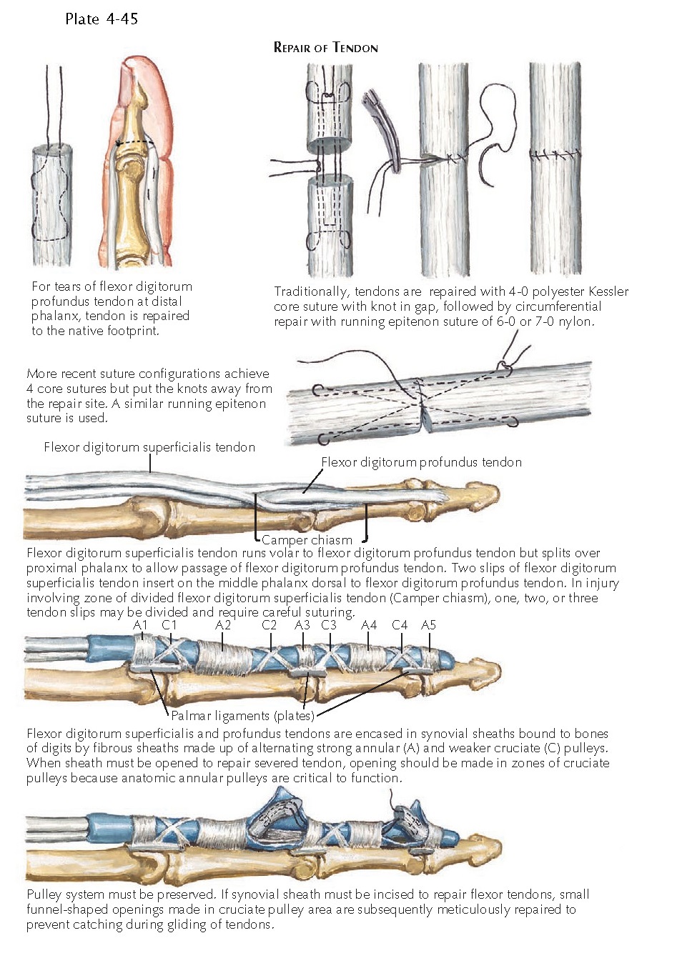 TENDON DISORDERS IN THE HAND - pediagenosis