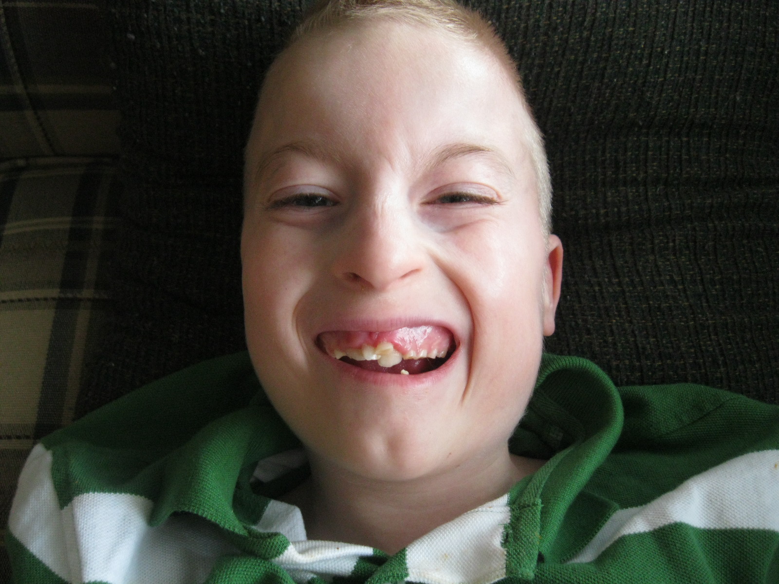 And Molly Makes Three....: Big Boy Teeth