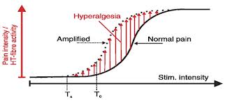 As Many Exceptions As Rules: Sweet Suffering
