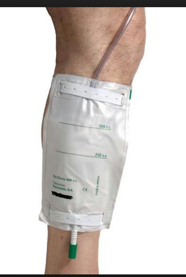 Nefrostomía Percutánea: Galería de imágenes