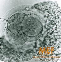 Museo de Embrio-Fetología "Dr. Jaime Pereda Tapiol": ¿Qué ocurre ...