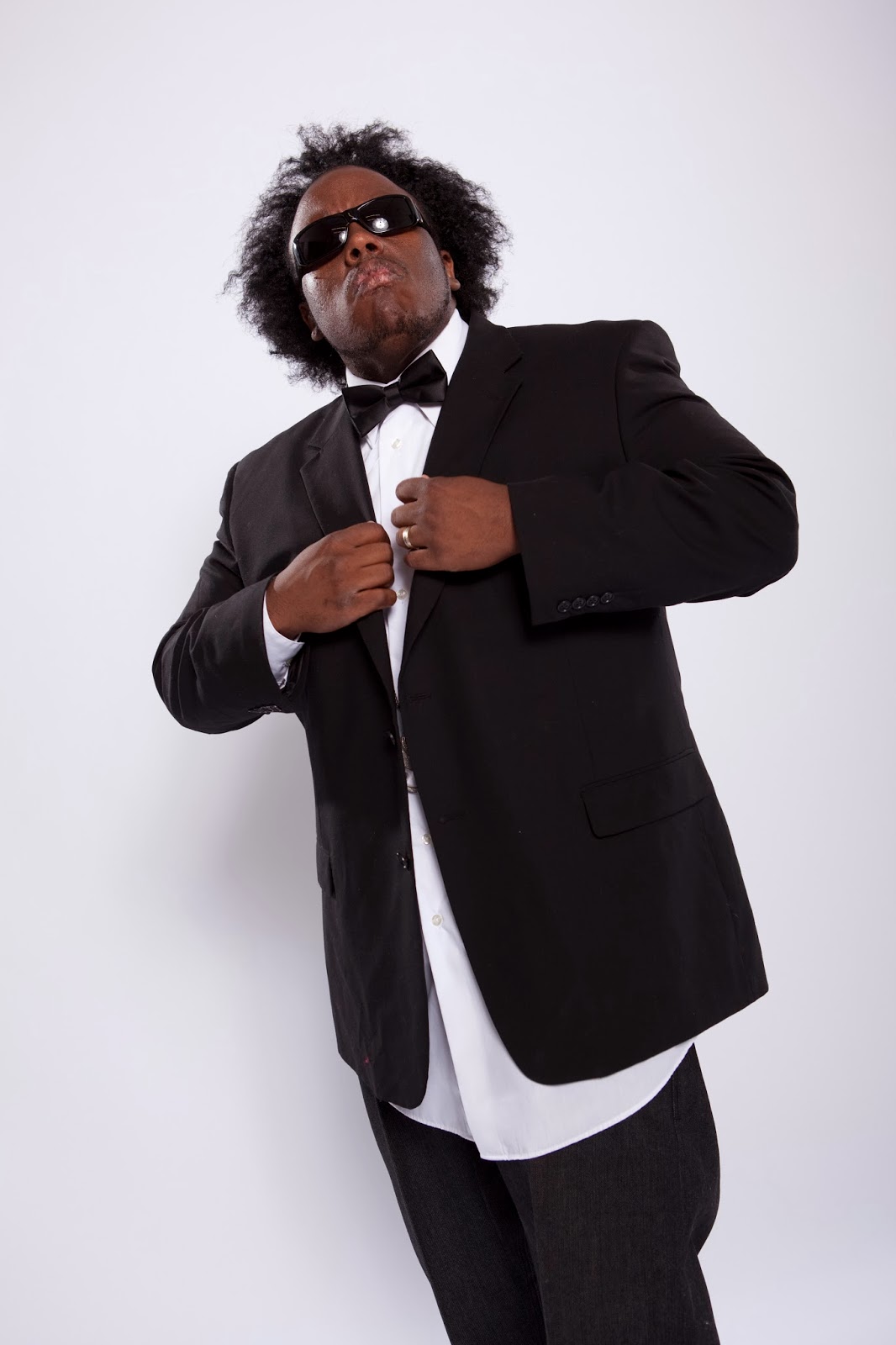 Krizz Kaliko Vitiligo