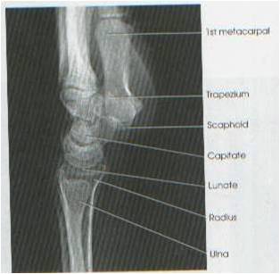 Catatan Ku: Teknik Radiografi Wrist Joint