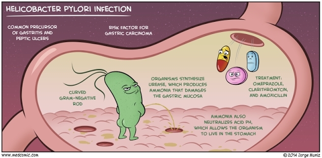 Release of Inspiration: The recurrence of H. pylori infection