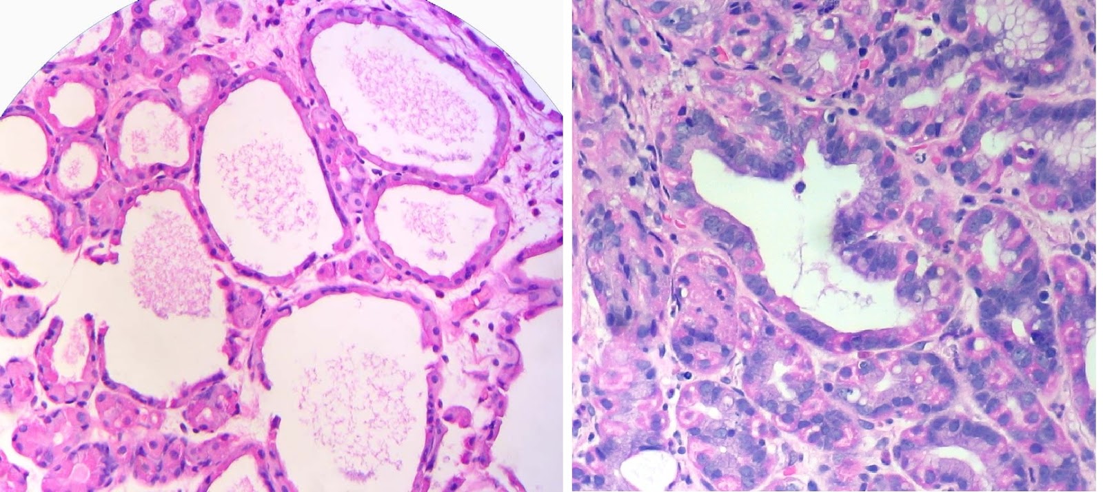 GASTROINTESTINAL AND LIVER HISTOLOGY PATHOLOGY ATLAS: STOMACH: FUNDIC ...
