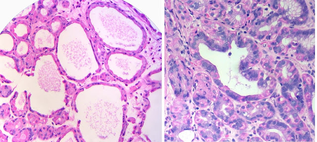 GASTROINTESTINAL AND LIVER HISTOLOGY PATHOLOGY ATLAS: STOMACH: FUNDIC ...