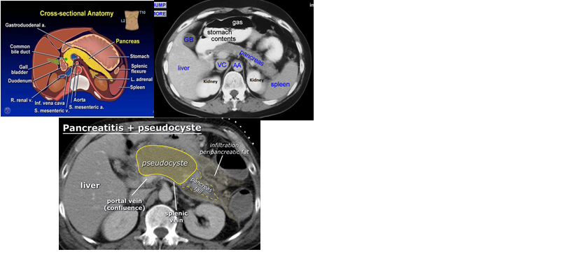easyhumanatomy: Summary of lesser sac : lecture note
