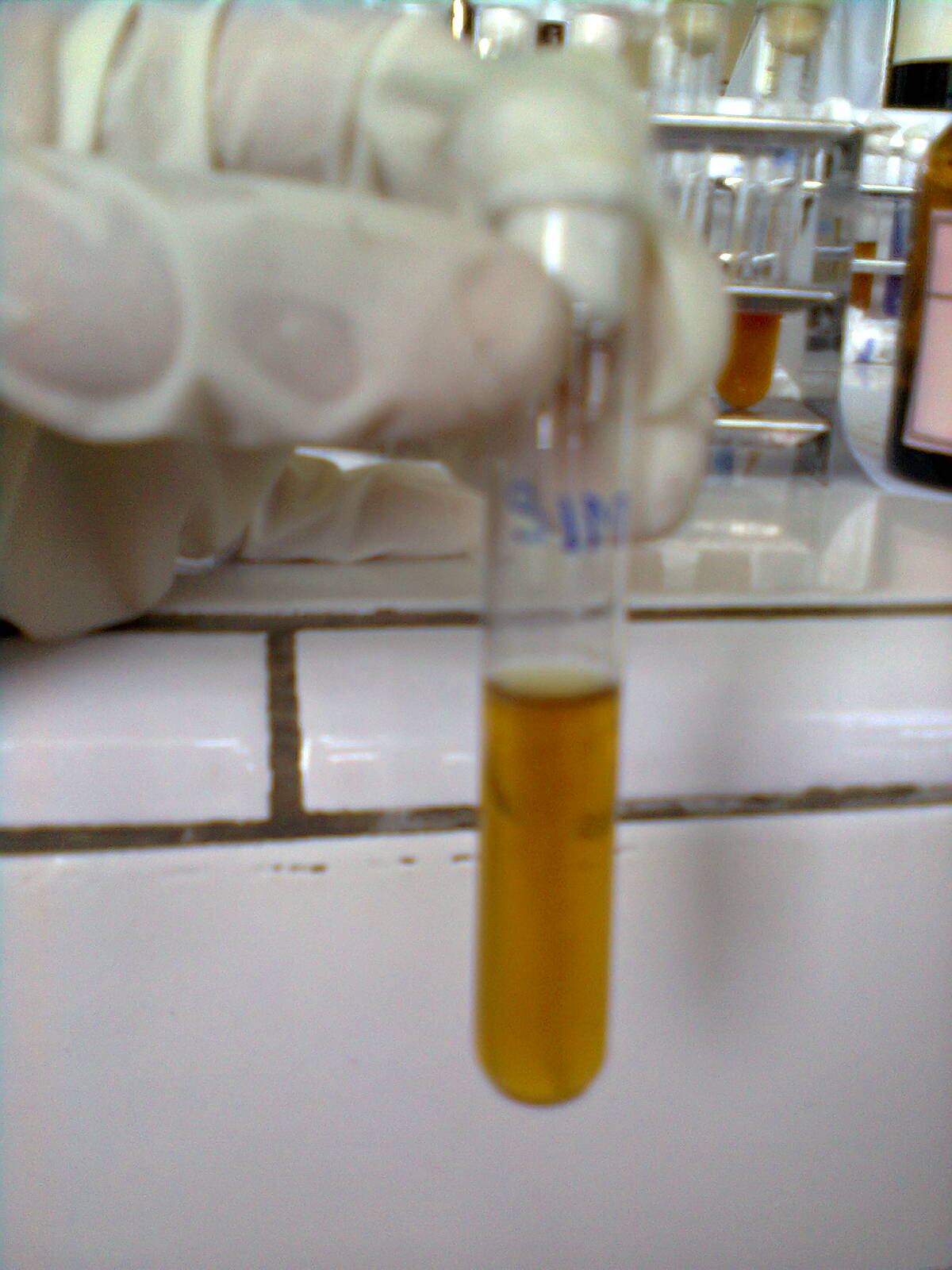 Teenoz Health Analyst: Gambar Hasil Identifikasi Klebsiella