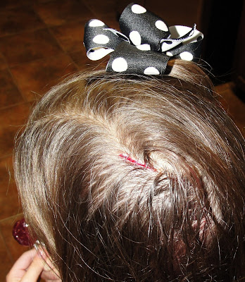 McCallum Memoirs: A SPLITTING HEAD ACHE