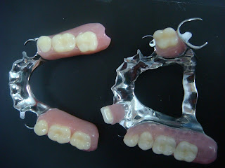 PROTESIS TOTAL: PrOtEsIS PaRcIaL ReMoViBle