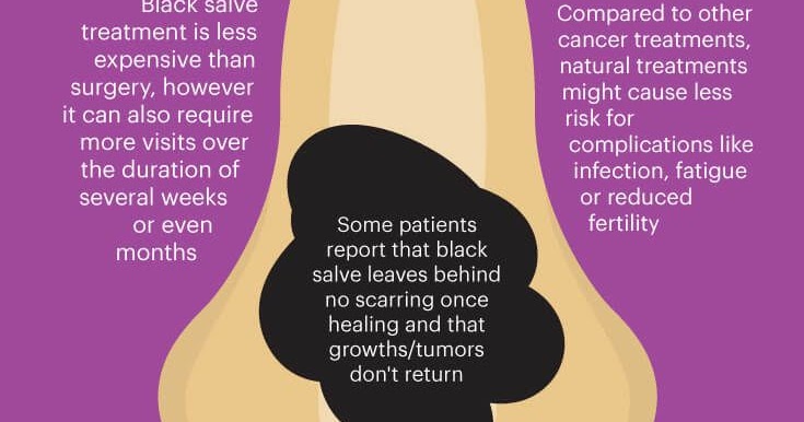 Cancer Treatment Side Effects - Facts That Can't Be Ignored