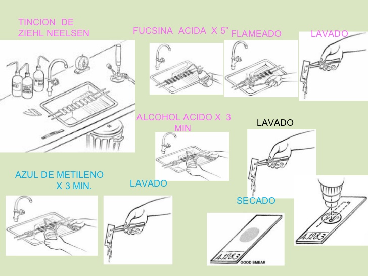 Coloracion De Giemsa Pasos - gudangmapa
