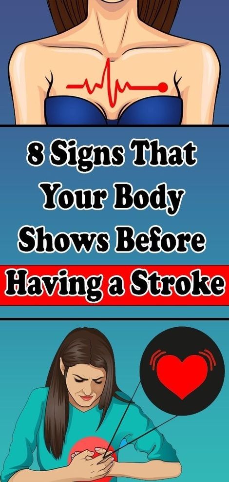 8 Signs That Your Body Shows Before Having a Stroke - wellness days