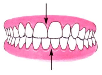 Bedont Orthodontics: March 2011