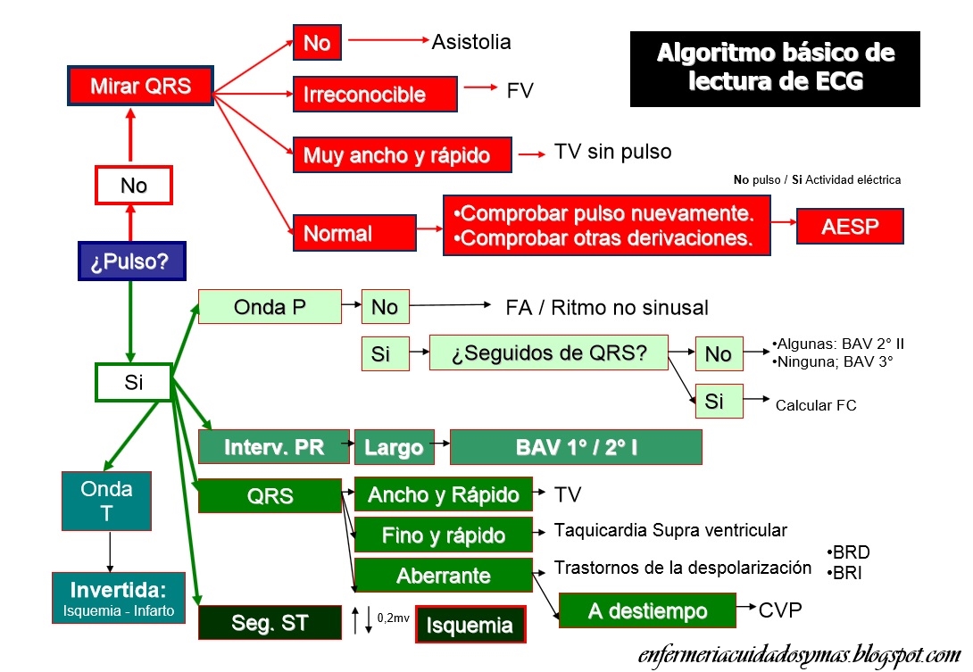 Todo sobre enfermería y medicina: Algoritmo básico de lectura de ECG
