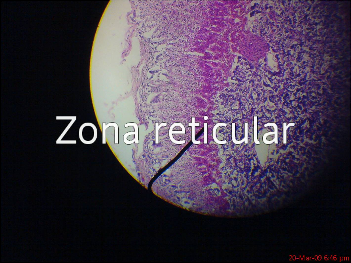 Zona Reticular; Reticular Adrenal; Reticular Suprarrenal; Zona ...