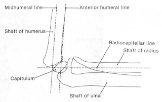 Medical Imaging Technology: Radiographic Anatomy of Elbow