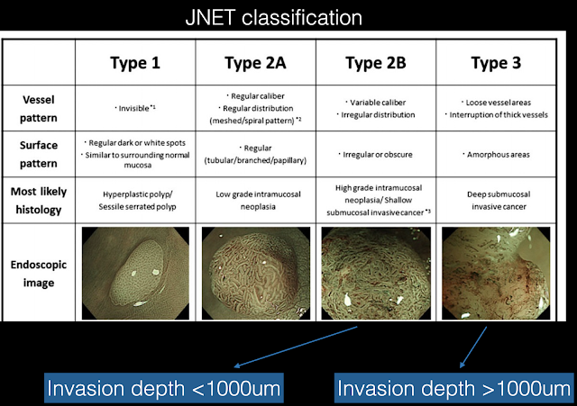 如何使用 窄頻光(NBI) 內視鏡觀察病變?